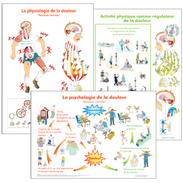 French - Trois affiches de douleur - 50x70cm - Holten Institute